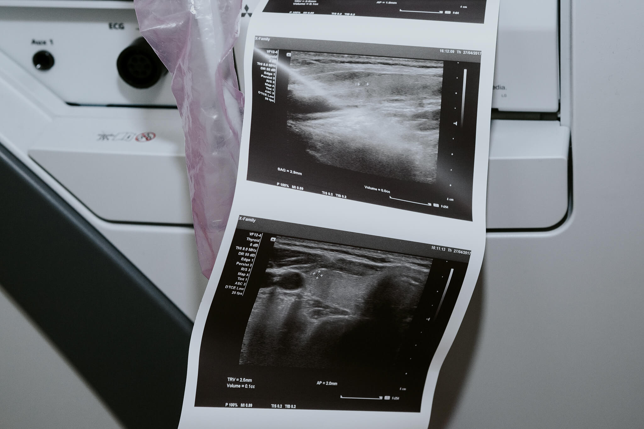 USG – pytania najczęściej zadawane przez pacjentów | NZOZ Revita